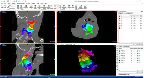Screenshot From The Segmentation Software The C1 To T1 Vertebrae Were