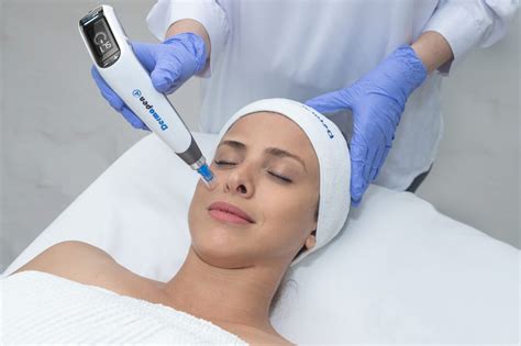 Find Out If Dermapen Treatment In Toronto Is Right For You Astra Medicare