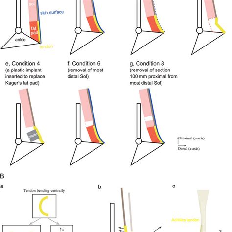 Modified Locking Loop Krackow Suture Technique Knot Is Placed At Other Download Scientific