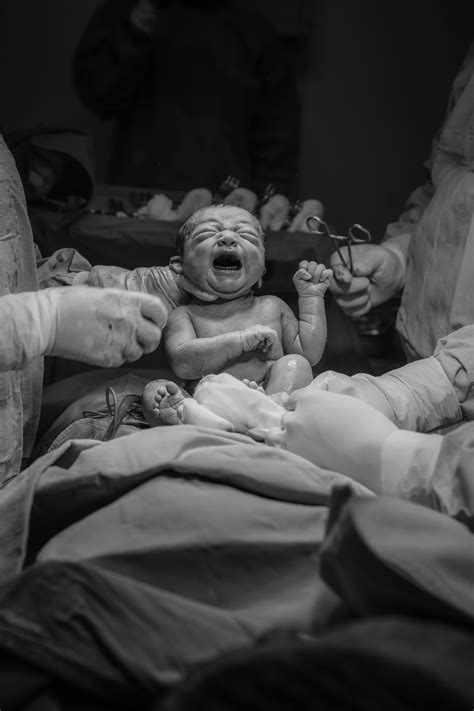 Gender Nullification Surgery Before And After Photos Download The Best