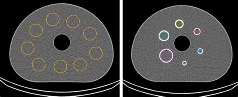delineation of the background voi left and the spheres right on the