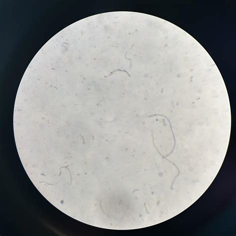 Need Help Identifying Large Strands In Freshwater Sample R Microscopy