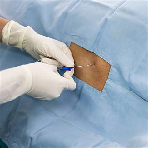 China Ultrasound Peripheral Nerve Block Needle Stainless Steel Stimulator Suppliers Factory