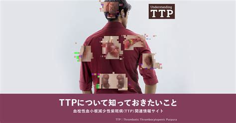 Ttpの診断｜ttpについて｜ttpについて知っておきたいこと（understanding Ttp）｜サノフィ株式会社（sanofi）