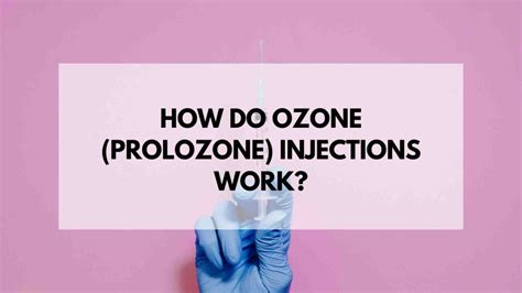 How Do Ozone Prolozone Injections Work Acupuncture Dry Needling Prolotherapy In Tampa Fl