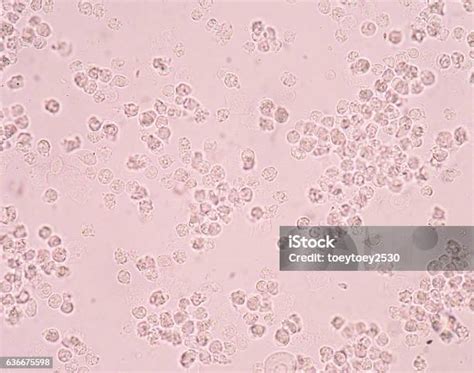 현미경 40x의 소변 표본에 있는 박테리아 Dna에 대한 스톡 사진 및 기타 이미지 Dna 개발 건강관리와 의술 Istock