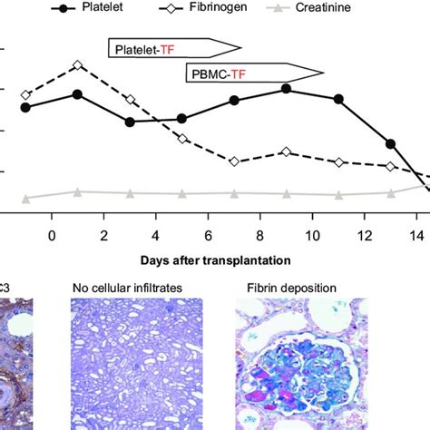 Correlation Between Platelet Count And Fibrinogen Level Indicating The Download Scientific