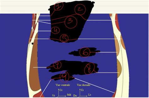 Radius Insertion Flashcards Quizlet Radius Insertion Flashcards Quizlet