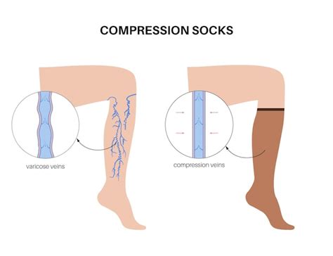 Compression Stocking Pressure Premium Vector
