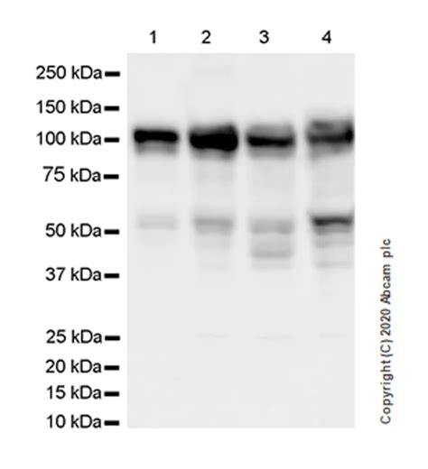 Anti Ythdc1 Antibody Epr21821 213 Ab259990 Abcam