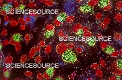 Chlamydia Infected Culture Under A Mic Stock Image Science Source