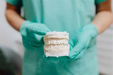 Here Is Everything That You Need To Know About Cast Partial Denture