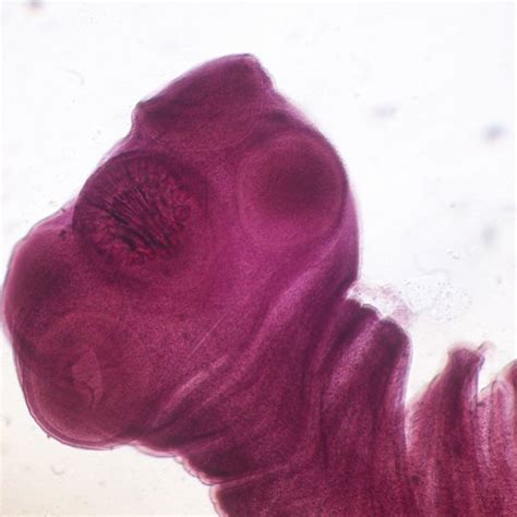 Epicollect5 Cbsua Cvm Porcine Cysticercosis Detection