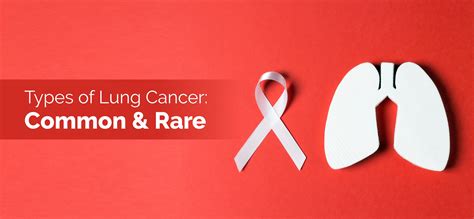 Types Of Lung Cancer Common And Rare Aakash Healthcare