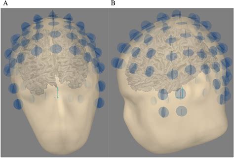 Frontiers A Fully Integrated Whole Head Helium Opm Meg A Performance