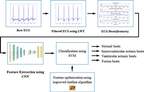 ecg classification flow diagram download scientific diagram