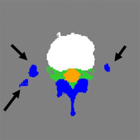 A Demonstration Of The Island Problem Download Scientific Diagram