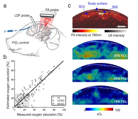 Large Scale Real Time Transcranial Neurophysiology Imaging Musiic