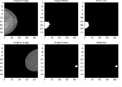 Figure 2 From Enhancing Breast Masses Detection And Segmentation A Novel U Net Based Approach