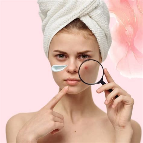 Best Acne And Pimple Creams In Pakistan Medicated Treatments For Clear