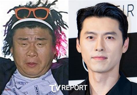 유명 개그맨 현빈처럼 수술하려다 사망 경고 받아