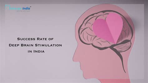 Success Rate Of Deep Brain Stimulation In India Deep Brain Stimulation In India