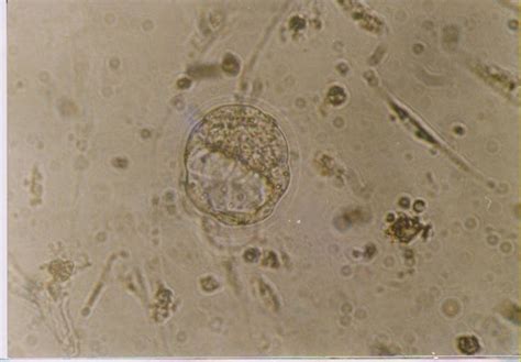 Blastocyst Recovered 35 Days After Fertilization X160 Showed The