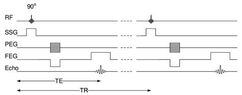 15 The Timing Diagram Of A Typical Gradient Echo Imaging Sequence Download Scientific Diagram