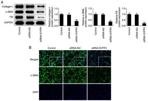 S1pr1 Silencing Restrains Keloid Fibroblast Fibrosis A Western Blot Download Scientific