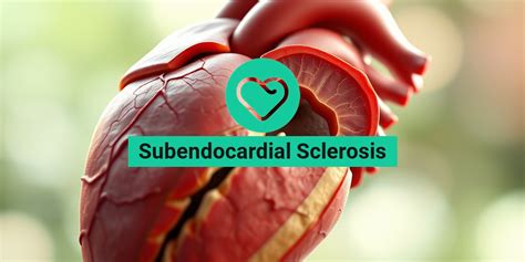 Subendocardial Sclerosis Understanding Causes Symptoms And Treatment • Yesil Health Ai