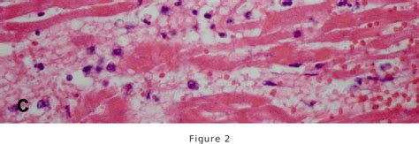 Figure 1 From Prevalence Of Cardiac Lesions In Cases Of Bovine