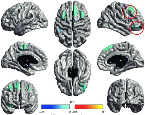 Clusters With Significant Age Sex Positive Maternal Behavior Download Scientific Diagram