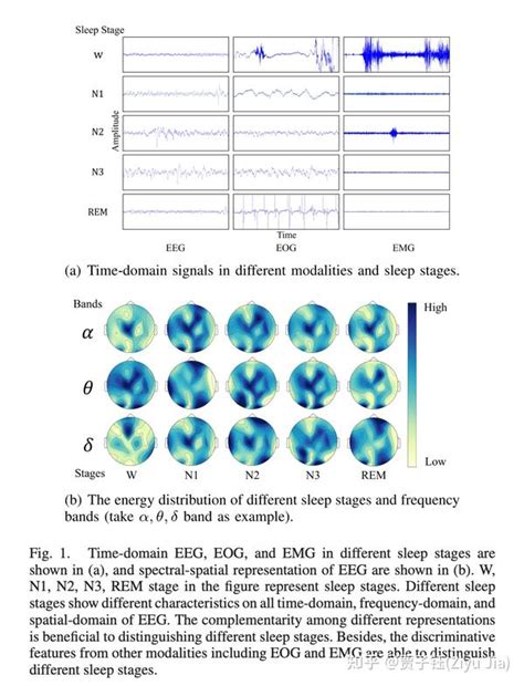 面向生理时间序列分类的多变量多模态模型 知乎