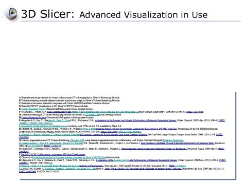 3 D Slicer A Free Open Source