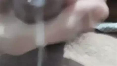 Schwanz Nach Der Beschneidung Xhamster