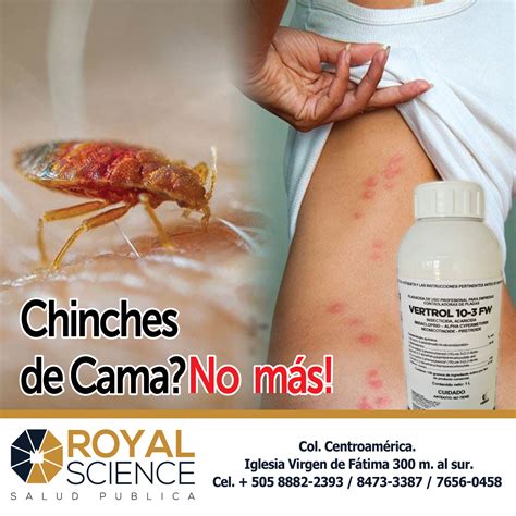 Royal 🛏️🚫 ¿te Pican Chinches En La Cama Aquí Te Contamos Los