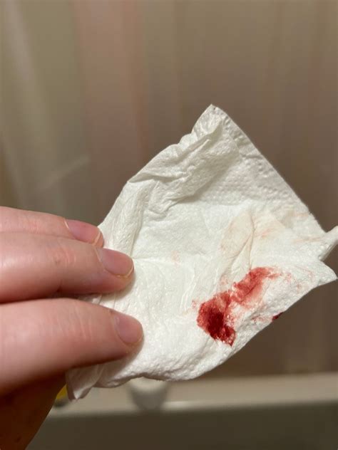 Bleeding During Ovulation Babycenter