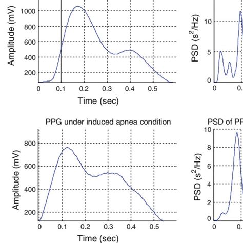 Ppg Waveforms Under Normal And Induced Apnea Download Scientific Diagram