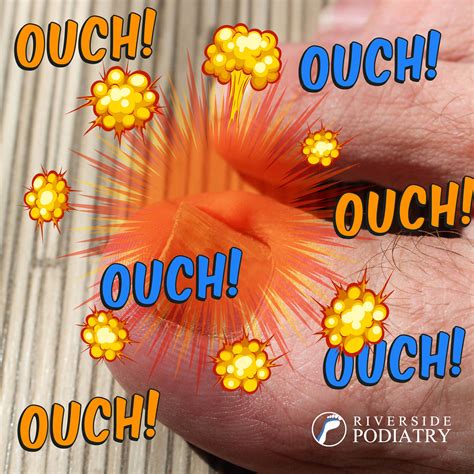 Ingrown Toenails Ouch Riverside Podiatry