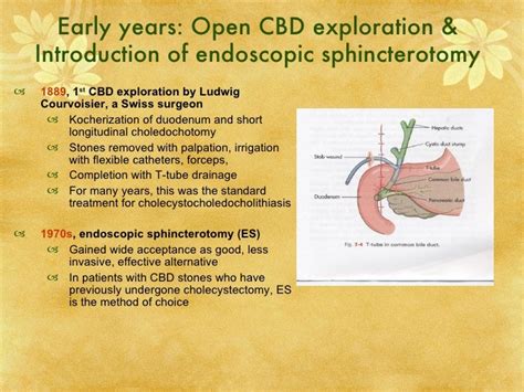 Cholangitis Treatment