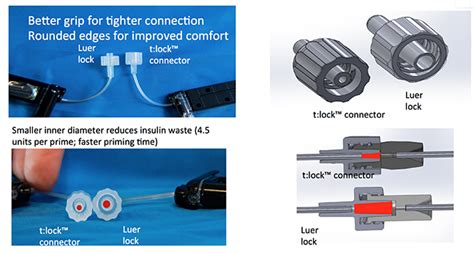 Tandem Diabetes Care Staying Alive And Focused