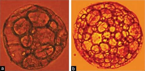 Microscopy Picture Of Polylactide Particles A Polylactide Particle Download Scientific