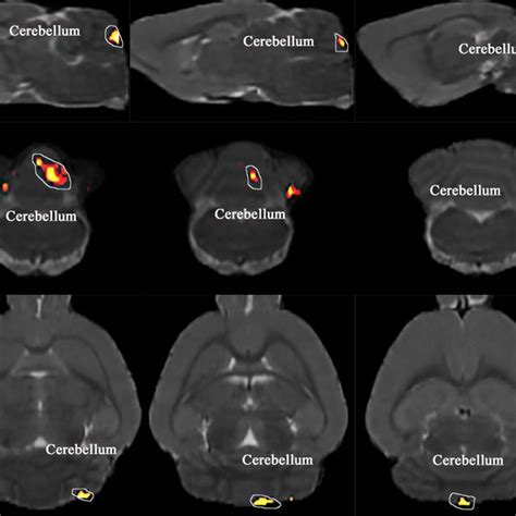 Anterior Cingulate Cortex ACC Seeds Across The Rats Imposed On The Download Scientific