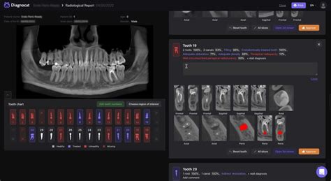 Revolutionising Dental Implant Planning Dentistry