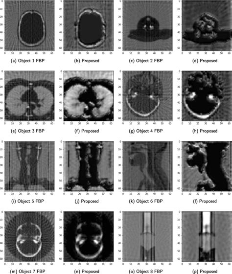 Reconstructed Images From 35 Projection Views Using Transform Based