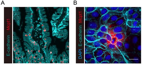 基础医学院胡小玉课题组合作发现上皮间肥大细胞功能 清华大学