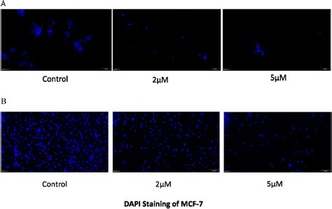 Nuclear Morphology Of Cancer Cells Was Seen By Dapi Staining Of Download Scientific Diagram