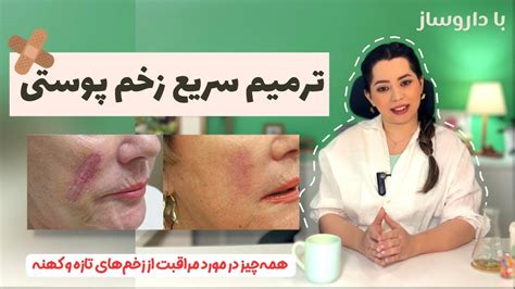 اقدامات ضروری در درمان جای زخم‌صفرتاصد ترمیم زخم،اسکار،بخیه و آسیب