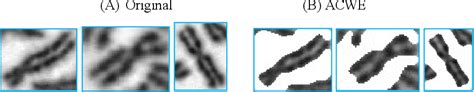 Deep Learning Based Automatic Detection Of Dicentric Chromosome