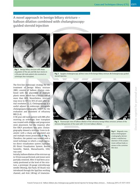 Pdf A Novel Approach In Benign Biliary Stricture Balloon Dilation